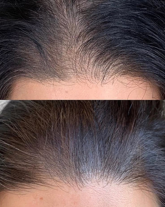 Daislashes Hair Serum – daislashes